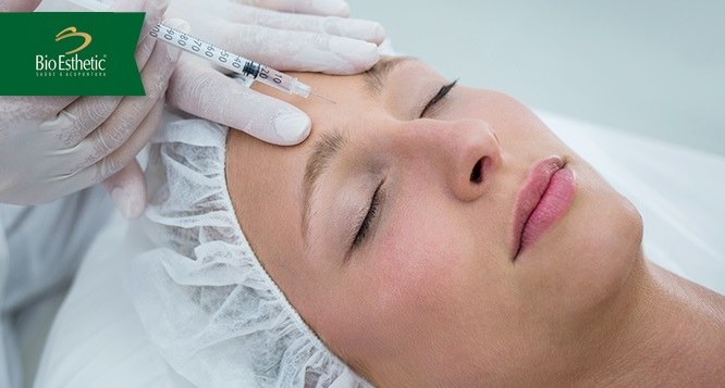Bio Esthetic, Aplicação de Botox na região T (testa, glabela, orbicular ...